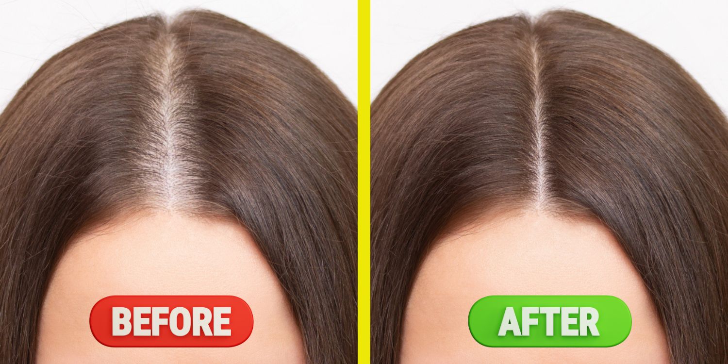 Special Offer || EverBella