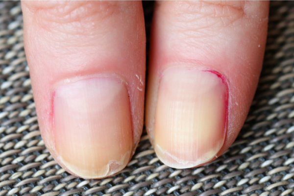 14 Tips For Stronger Nails - EVERBELLA